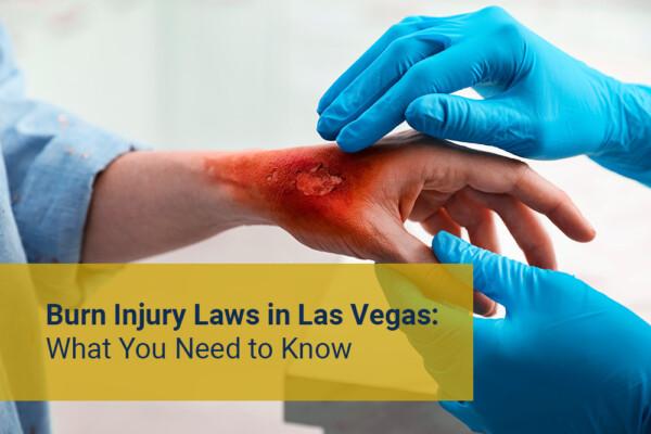 Burn Injury Laws in Las Vegas: What You Need to Know
